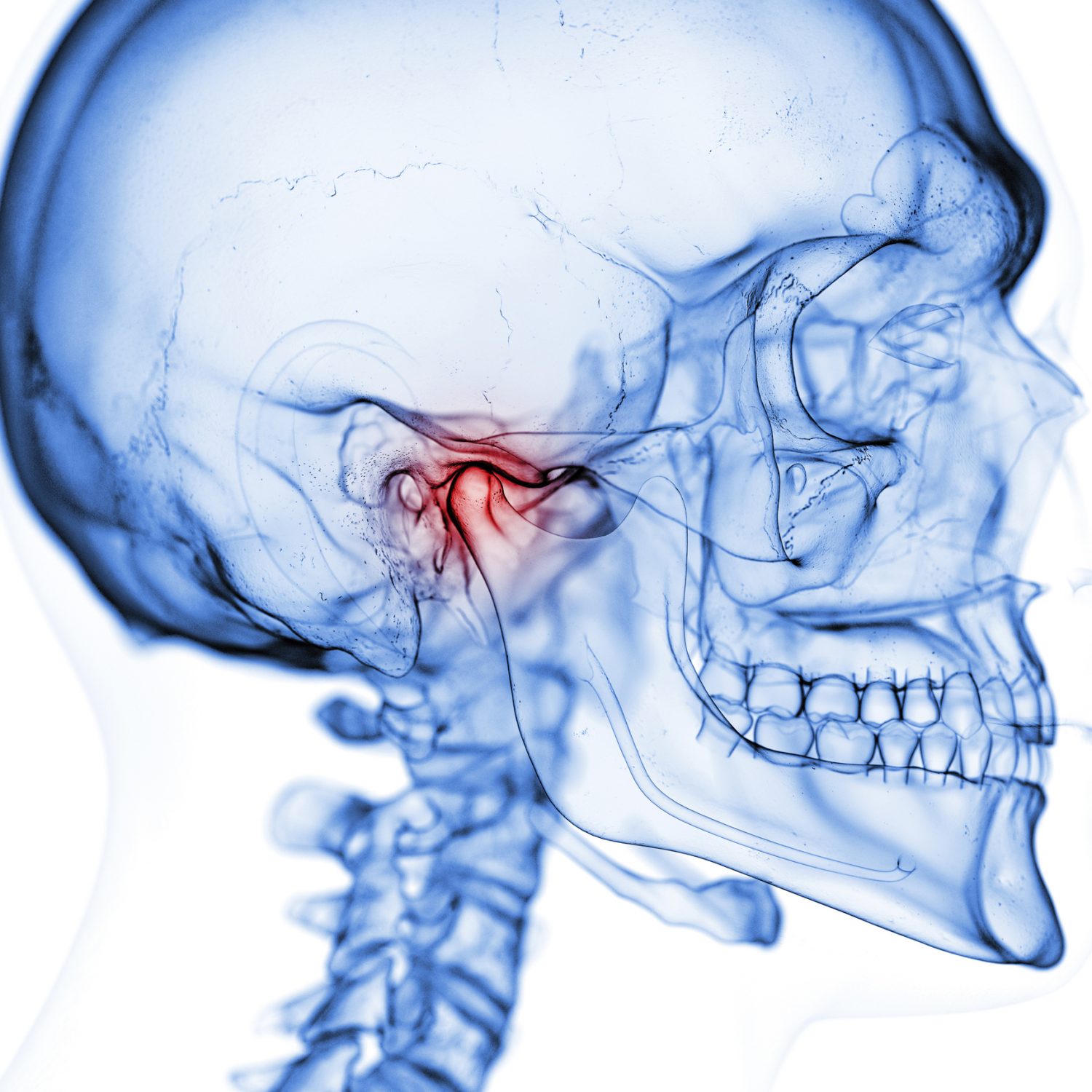 Jaw Pain